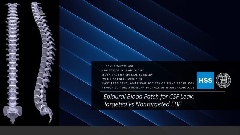 Talk 16 – Amrhein & Chazen – Controversies in EBP – Targeted Epidural ...